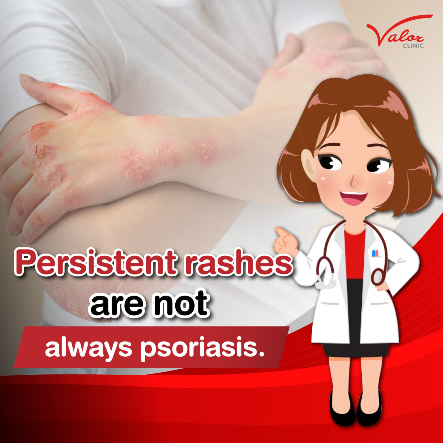 Persistent rashes are not always psoriasis. - Valor Clinic