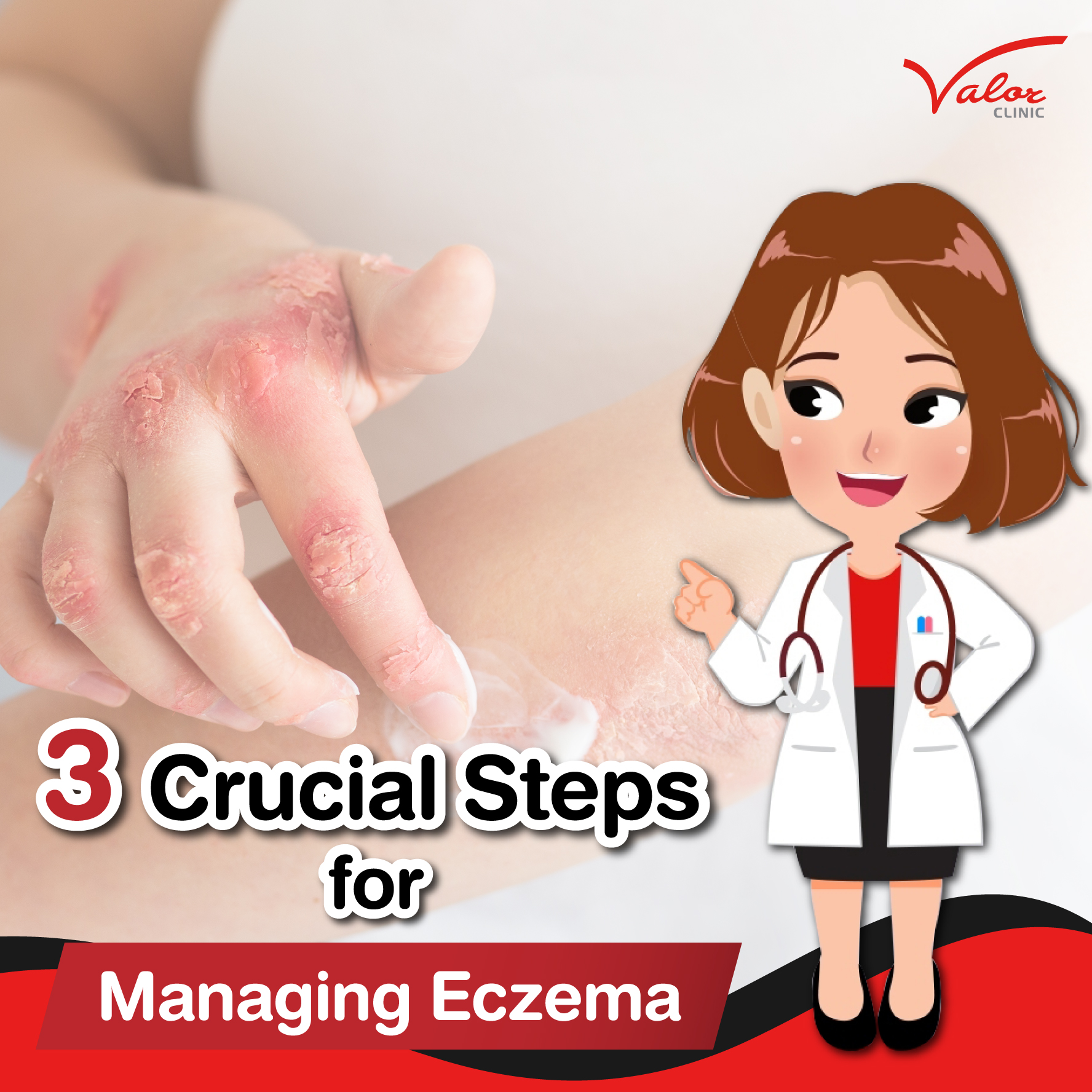 3 Crucial Steps for Managing Eczema - Valor Clinic