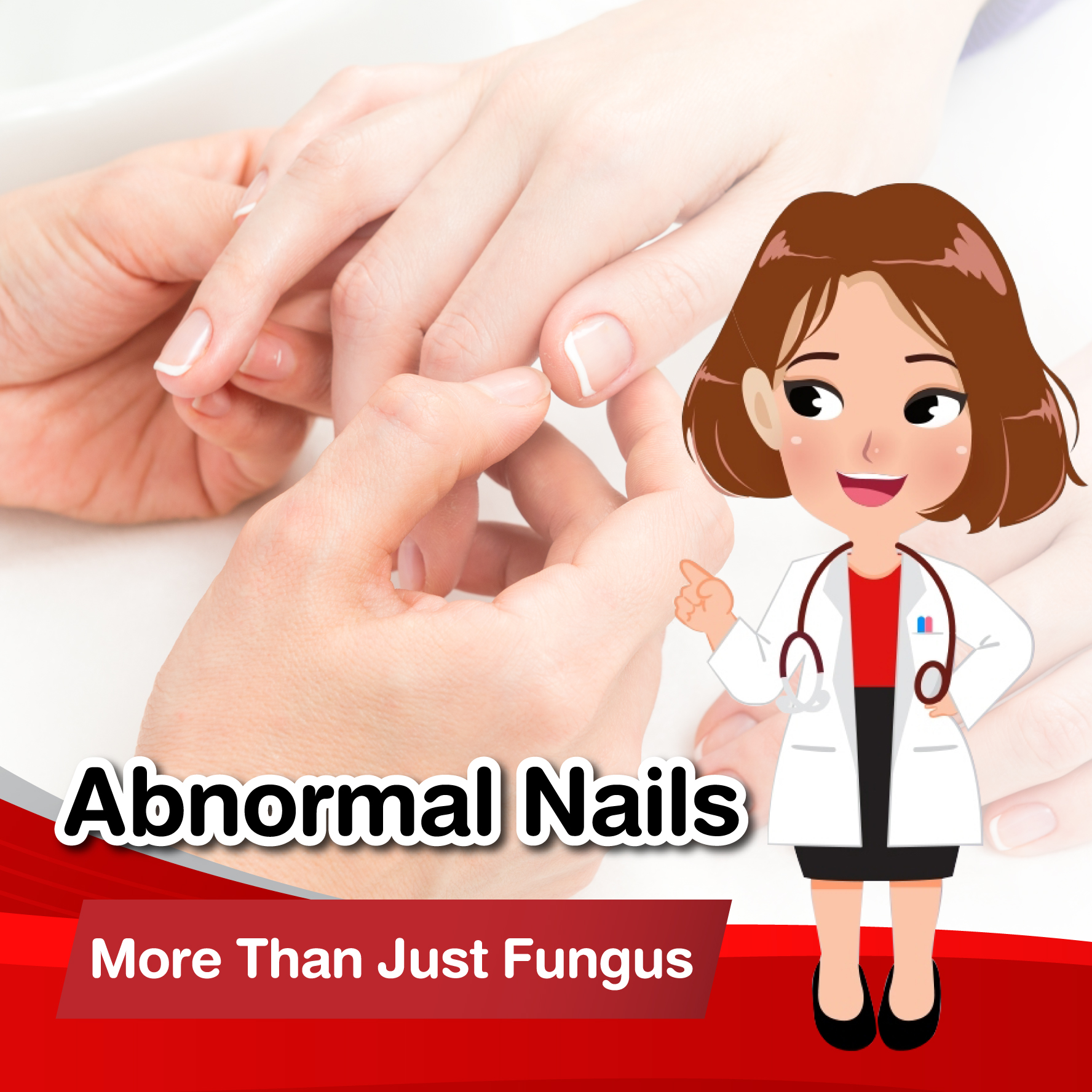 Abnormal Nails More Than Just Fungus - Valor Clinic