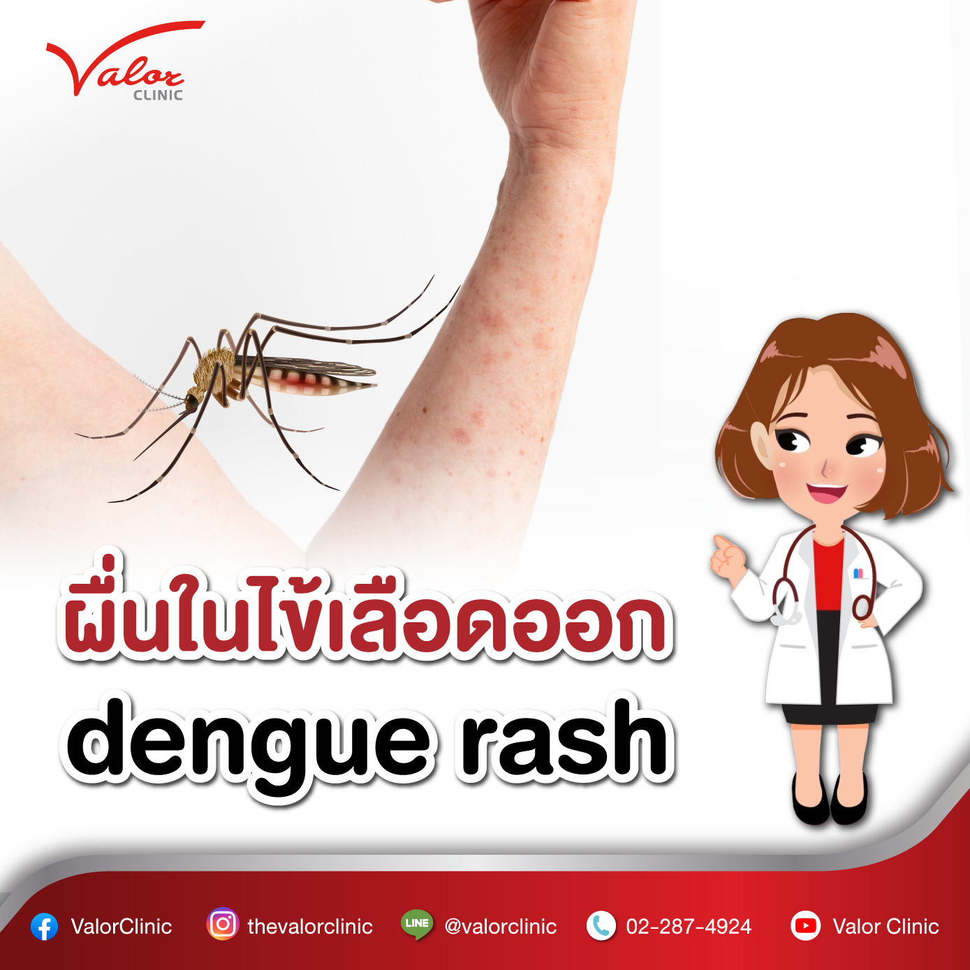 ผื่นในไข้เลือดออก (Dengue Rash) - เวเลอร์คลินิก